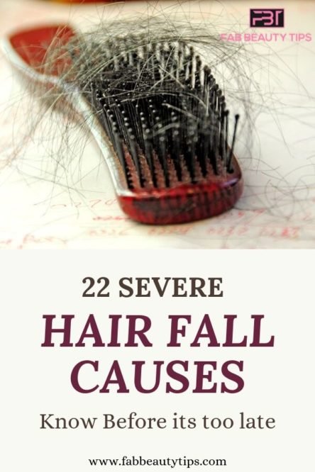 22 Severe Hair Fall Causes You Should Know Before Its Too Late